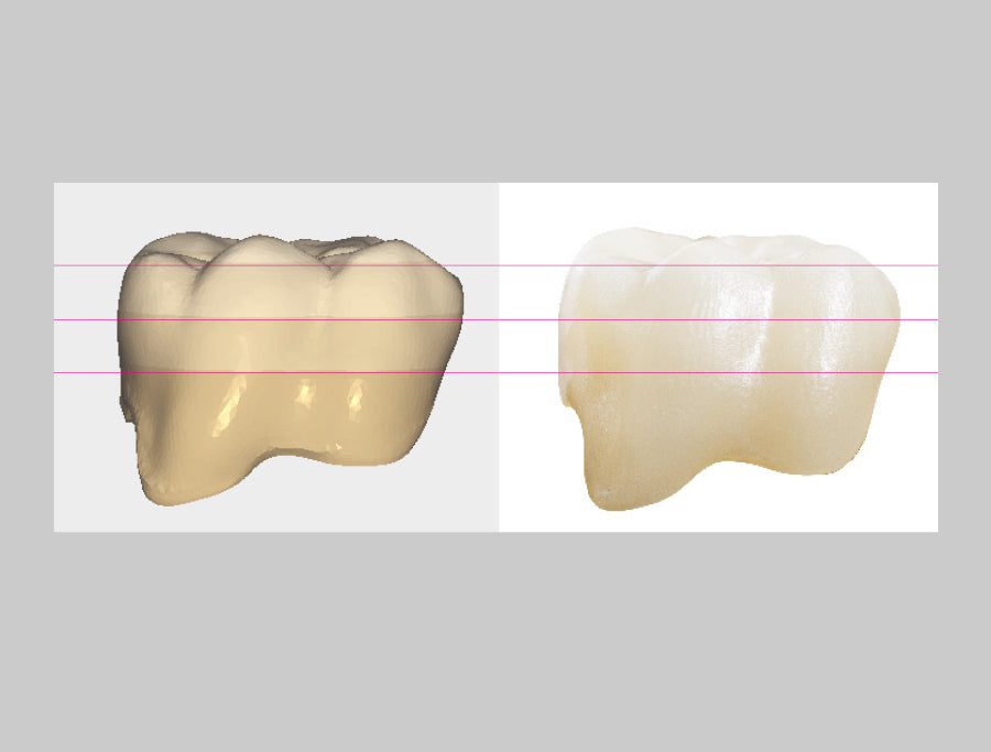Mastering CAD/CAM Nesting: Advanced Techniques for Modern Dental Labs ...